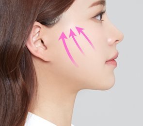 Face Contouring - Made Young